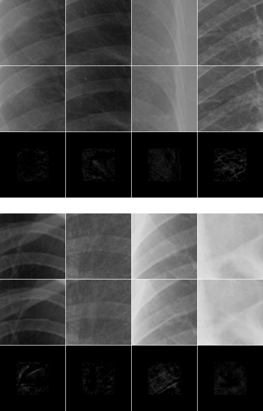 Chest X-Rays Image Inpainting with Context Encoders | DeepAI