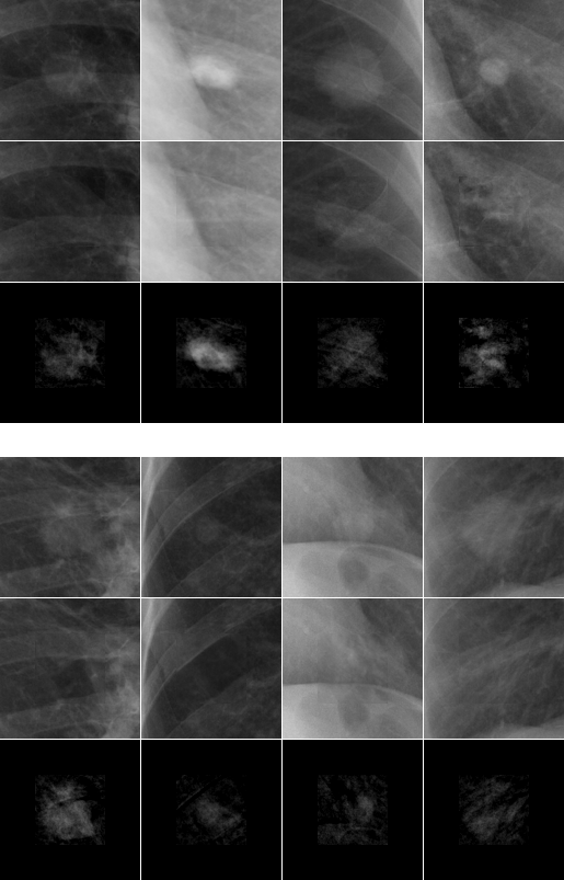 Chest X-Rays Image Inpainting with Context Encoders | DeepAI