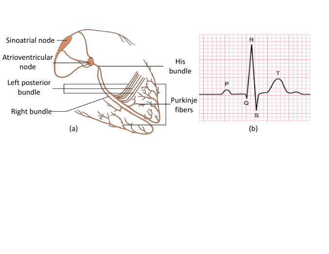 LSTM-Based ECG Classification for Continuous Monitoring on Personal Wearable Devices | DeepAI