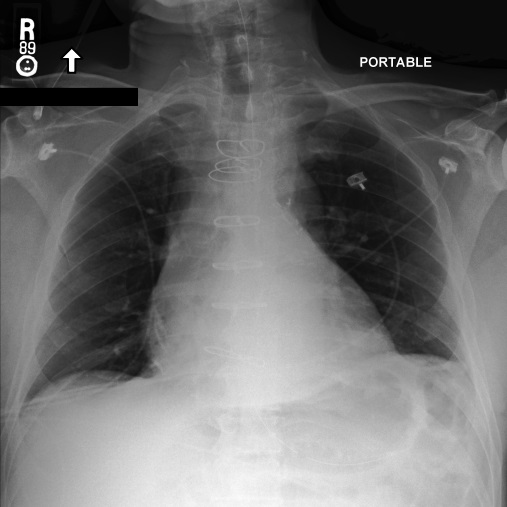 MIMIC-CXR: A large publicly available database of labeled chest radiographs | DeepAI