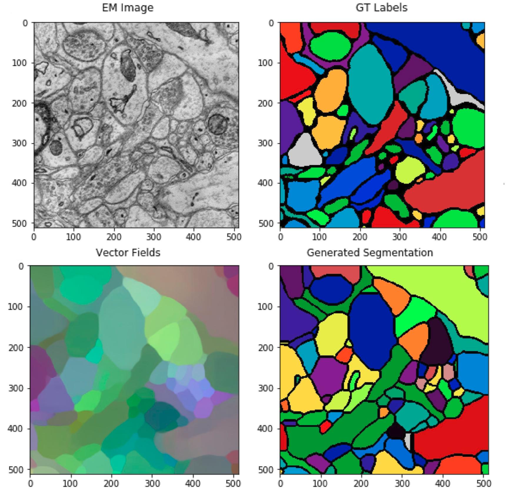 Learning Metric Graphs for Neuron Segmentation In Electron Microscopy Images | DeepAI