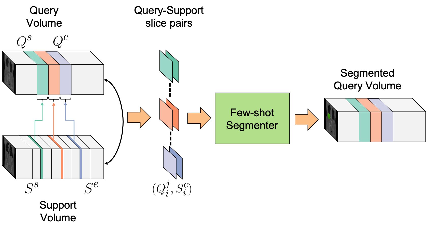 'Squeeze & Excite' Guided Few-Shot Segmentation of Volumetric Images | DeepAI