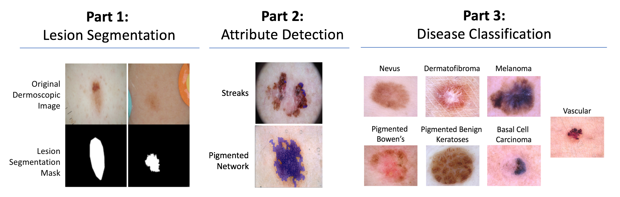 Skin Lesion Analysis Toward Melanoma Detection 2018: A Challenge Hosted ...