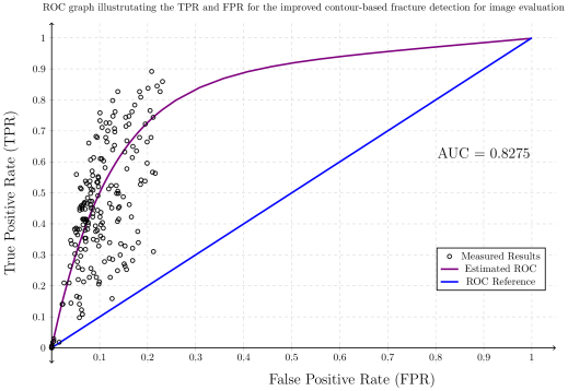 Long Bone Fracture Detection Using Artificial Neural Networks Based On Contour Features Of X Ray 7977