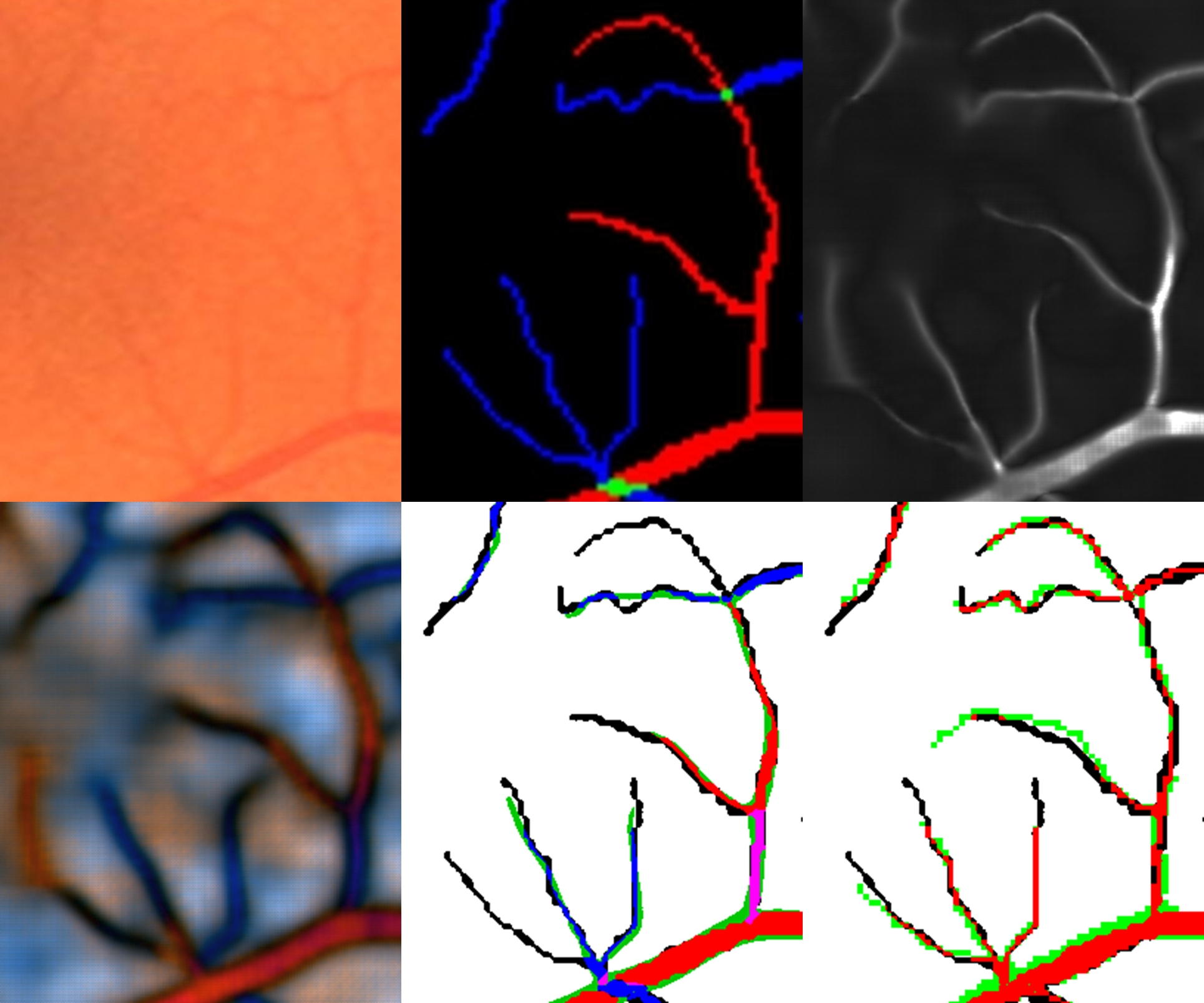 Joint segmentation and classification of retinal arteries/veins from ...