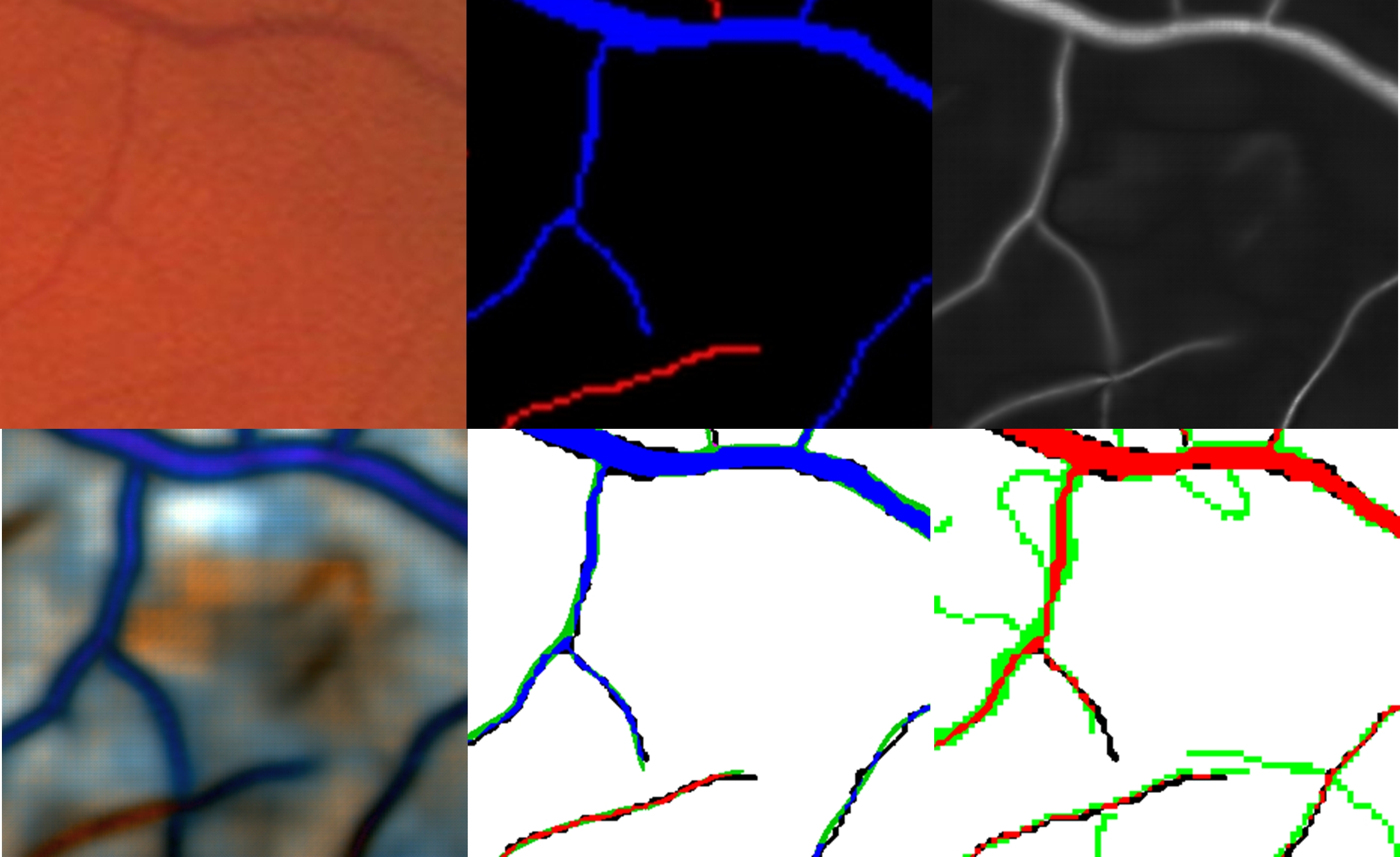 Joint segmentation and classification of retinal arteries/veins from ...