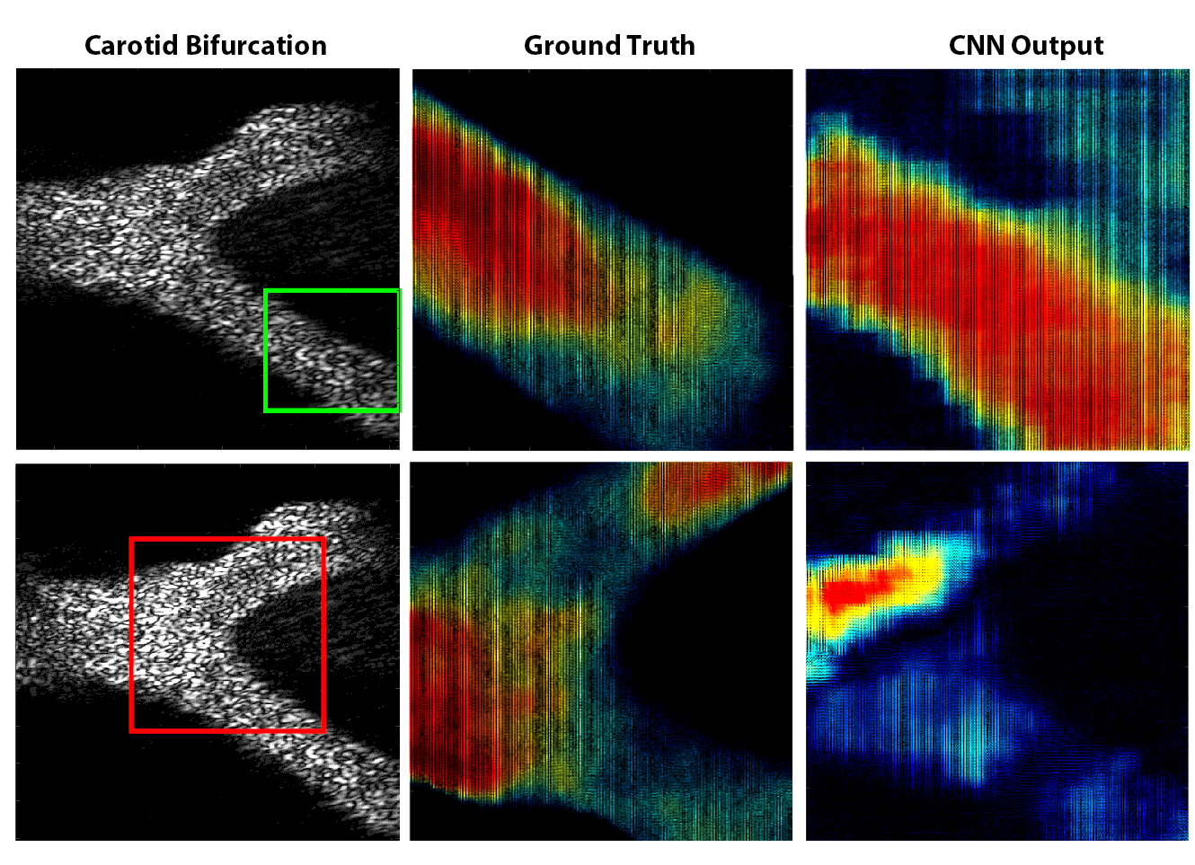 Demonstration of Vector Flow Imaging using Convolutional Neural ...