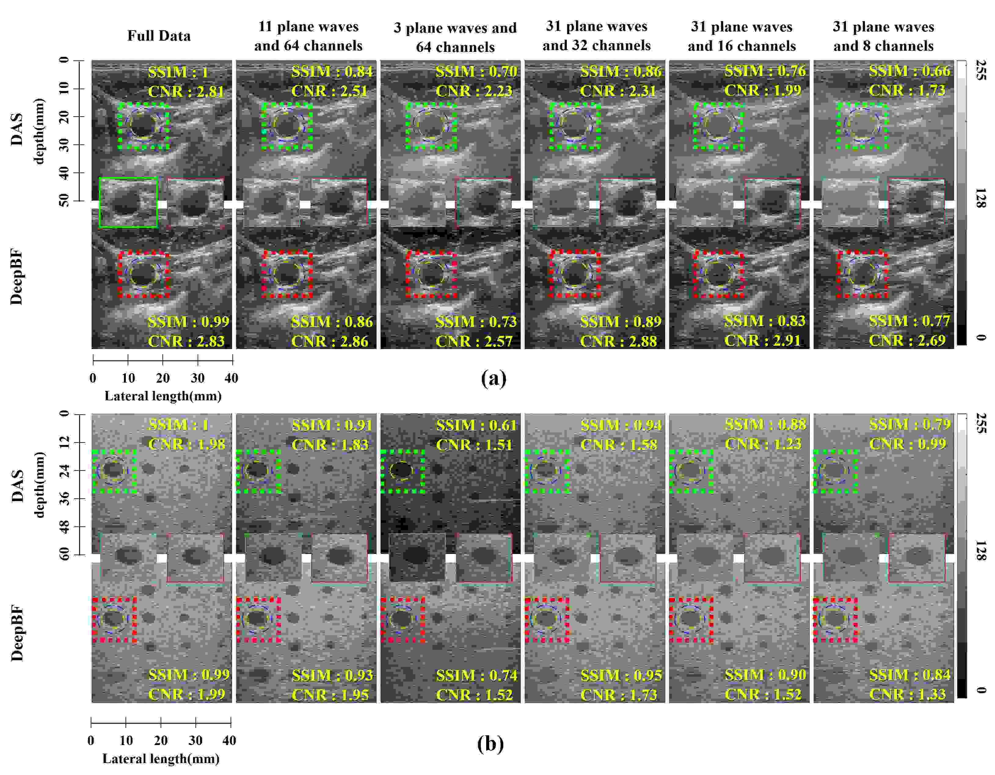 Deep Learning-based Universal Beamformer for Ultrasound Imaging | DeepAI