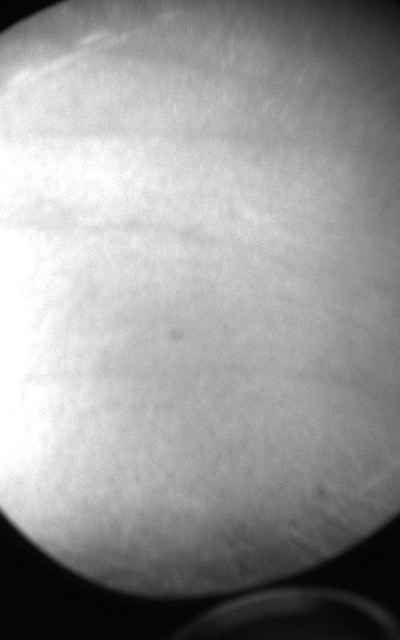 OpenEDS: Open Eye Dataset | DeepAI