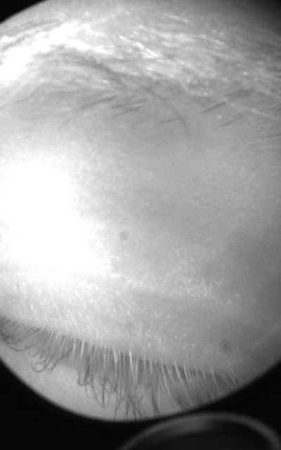 OpenEDS: Open Eye Dataset | DeepAI