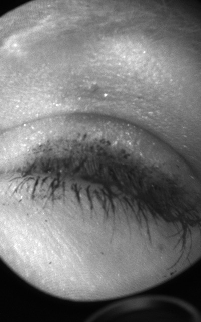 OpenEDS: Open Eye Dataset | DeepAI