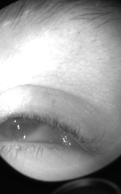 OpenEDS: Open Eye Dataset | DeepAI