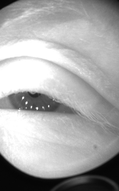 OpenEDS: Open Eye Dataset | DeepAI