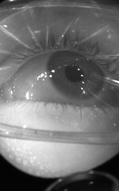 OpenEDS: Open Eye Dataset | DeepAI