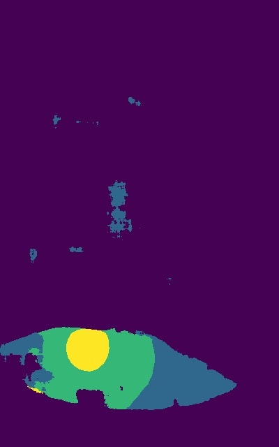 OpenEDS: Open Eye Dataset | DeepAI