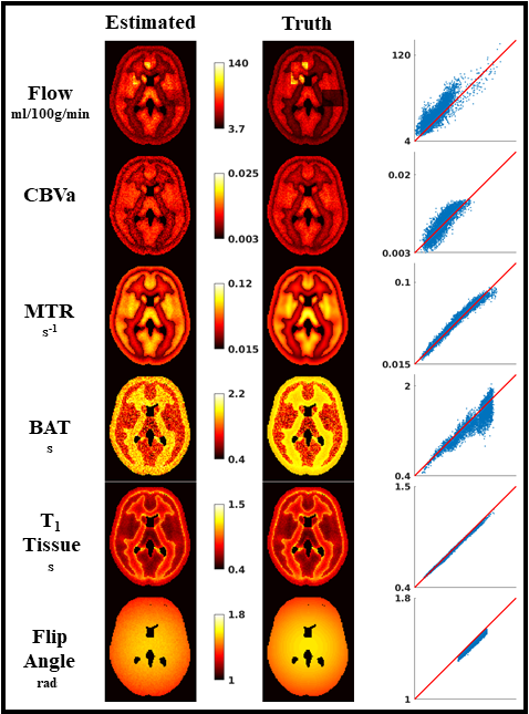 Optimizing MRF-ASL Scan Design for Precise Quantification of Brain ...