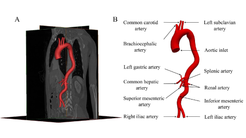 Efficient Parallel Simulation of Blood Flows in Abdominal Aorta | DeepAI