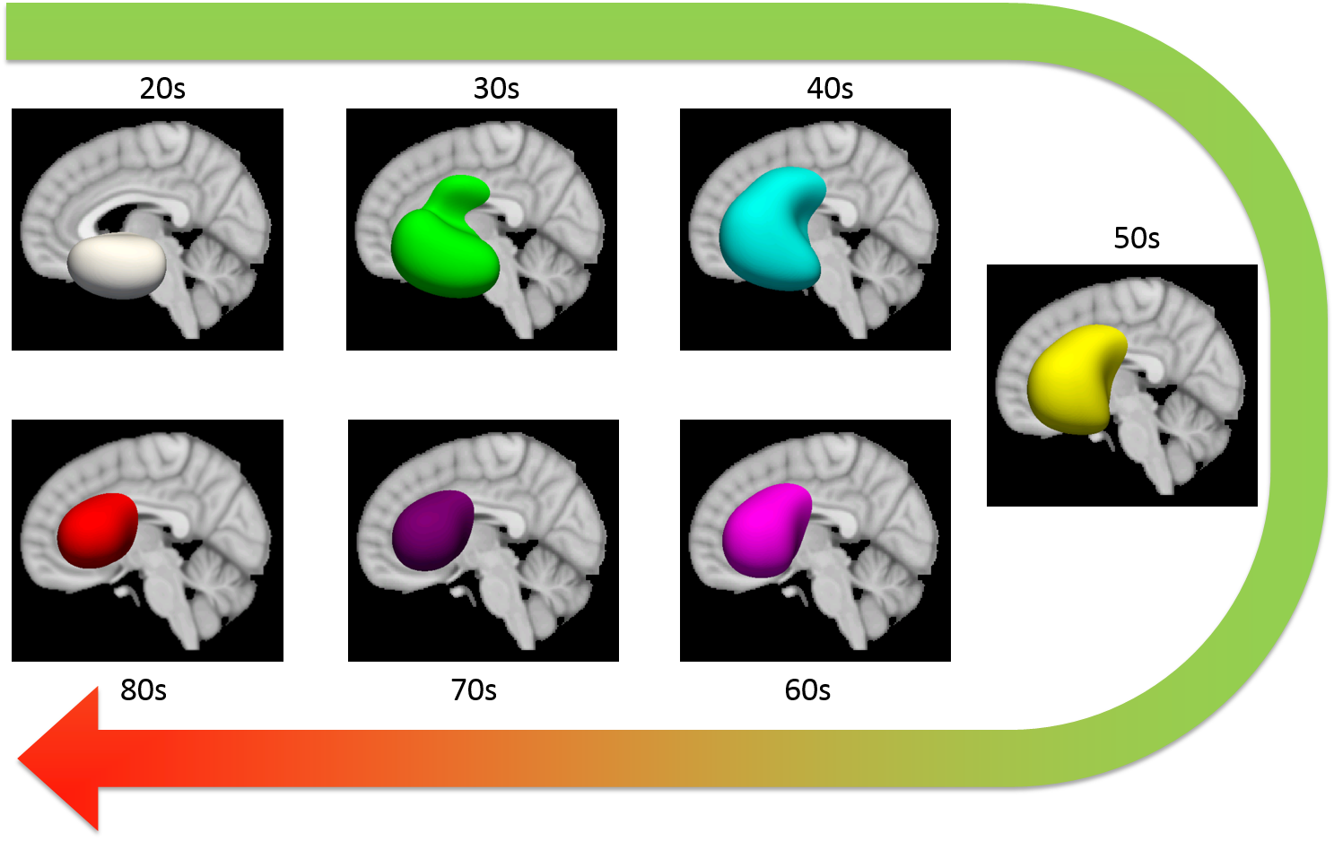 Estimating brain age based on a healthy population with deep learning ...