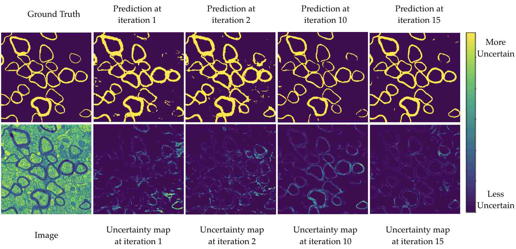 Deep Active Learning for Axon-Myelin Segmentation on Histology Data ...