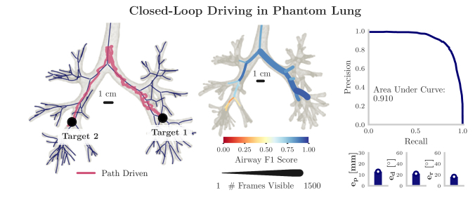 Autonomous Driving in the Lung using Deep Learning for Localization ...