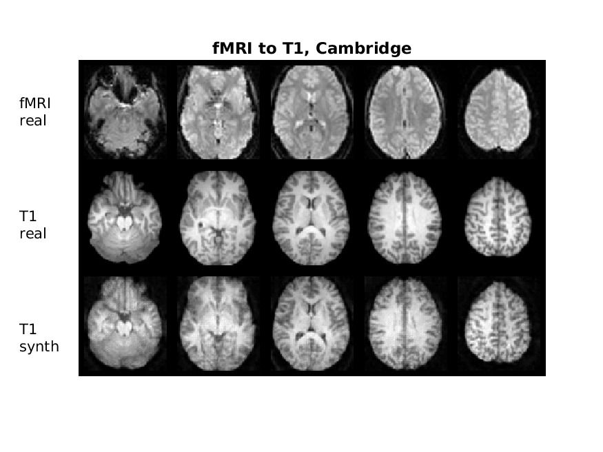 Generating fMRI volumes from T1-weighted volumes using 3D CycleGAN | DeepAI