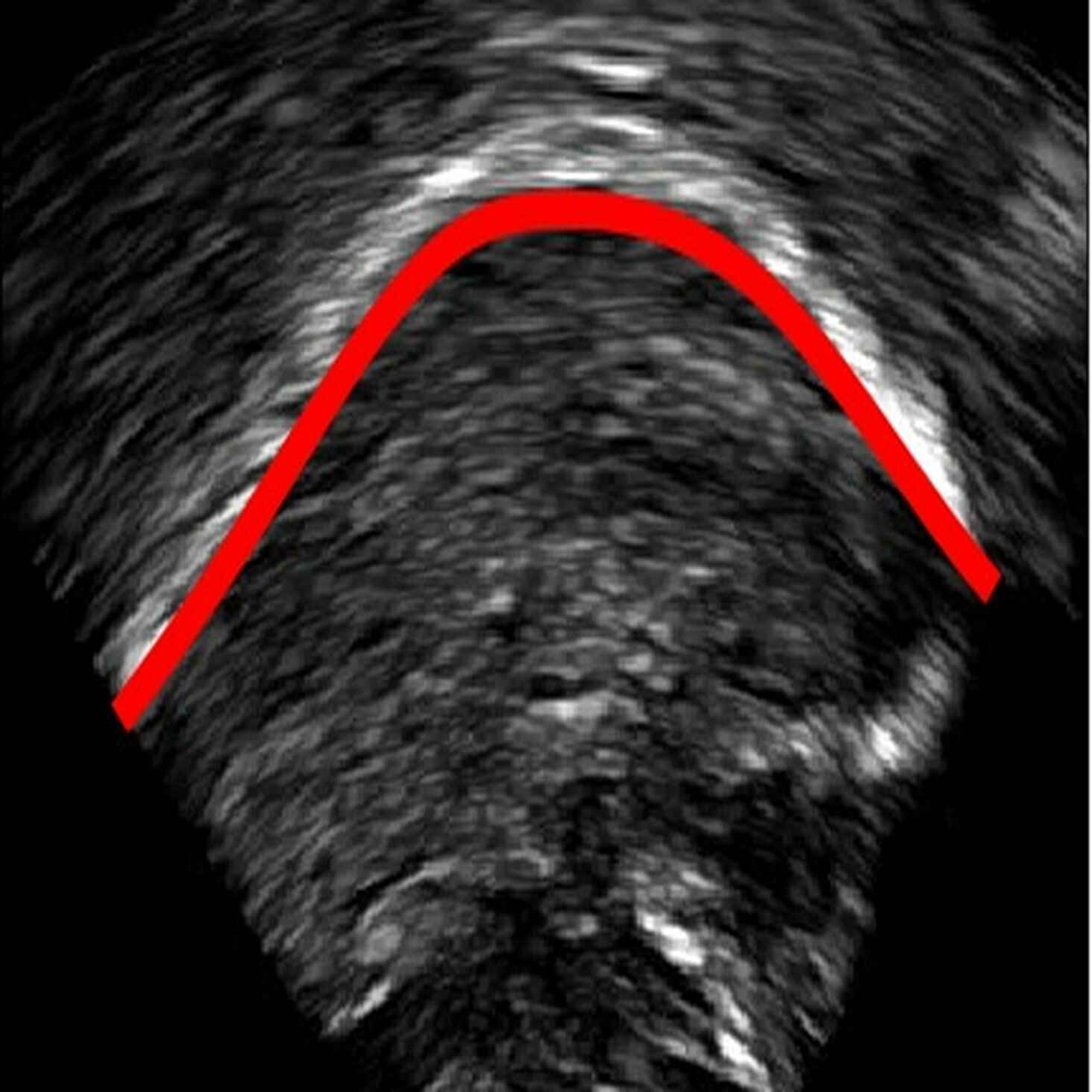 A Cnn Based Tool For Automatic Tongue Contour Tracking In Ultrasound Images Deepai
