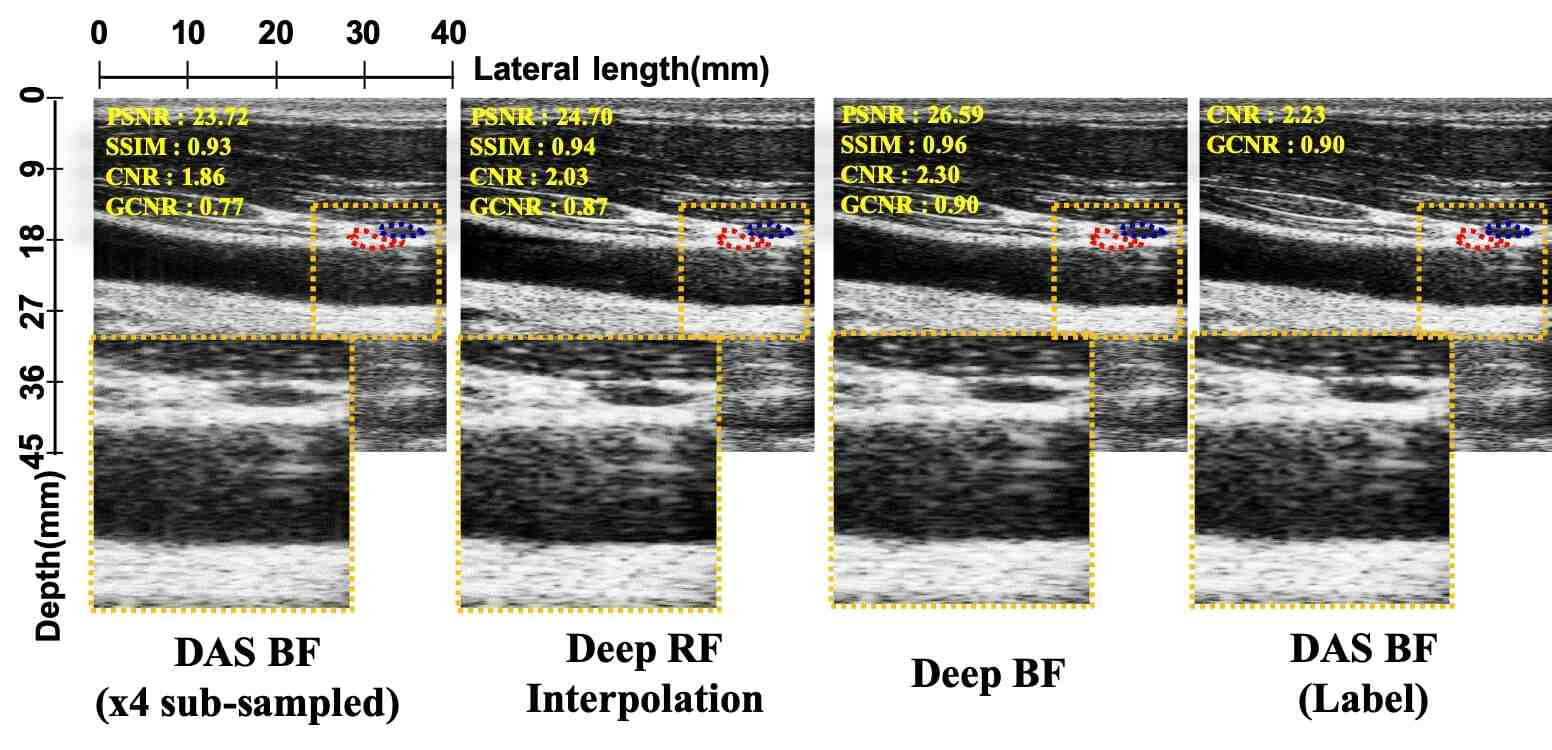 Adaptive and Compressive Beamforming using Deep Learning for Medical ...