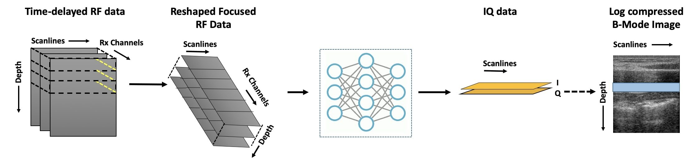 Adaptive and Compressive Beamforming using Deep Learning for Medical Ultrasound | DeepAI