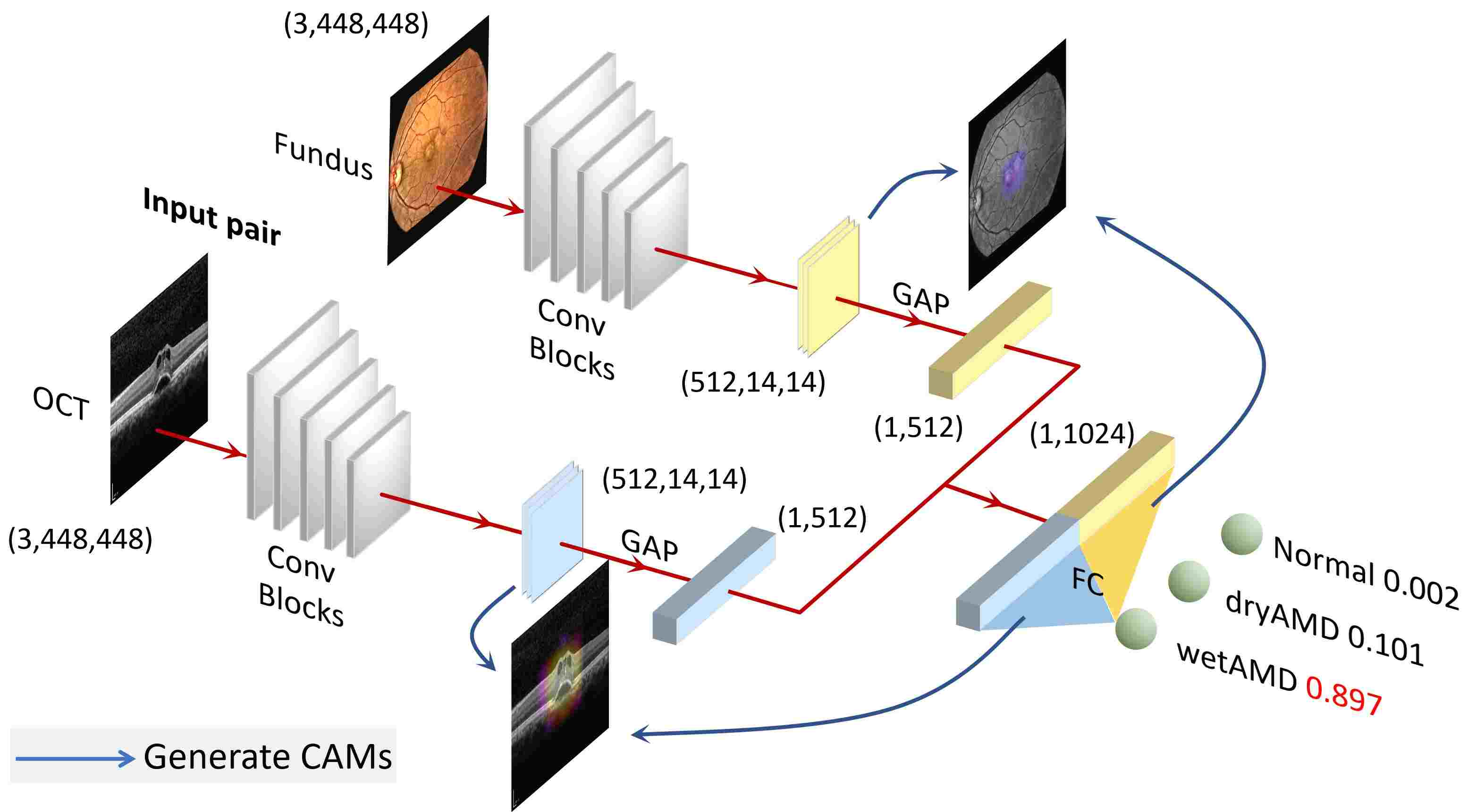 Two-Stream CNN with Loose Pair Training for Multi-modal AMD ...