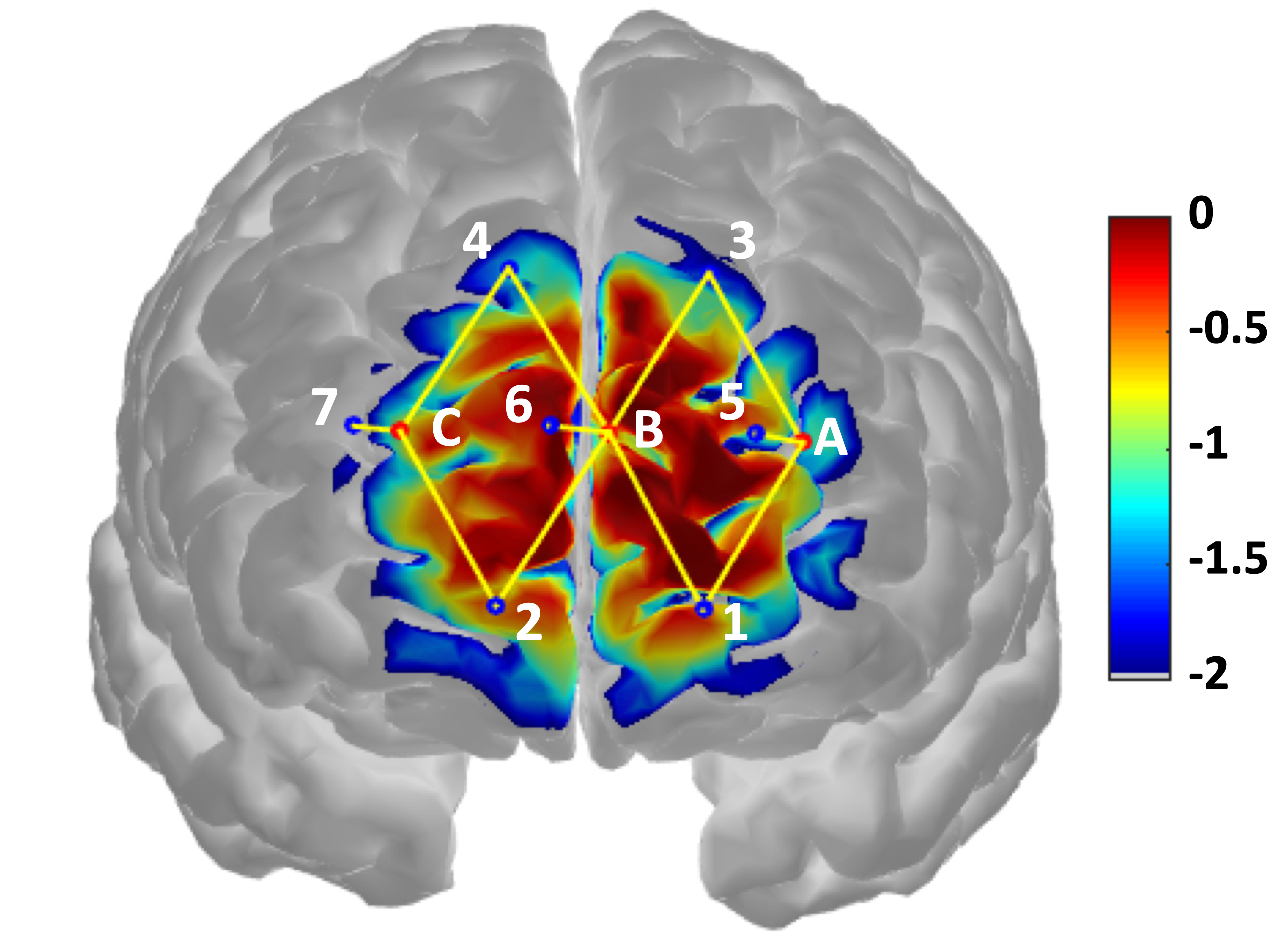 Pain Detection with fNIRS-Measured Brain Signals: A Personalized Machine Learning Approach Using ...