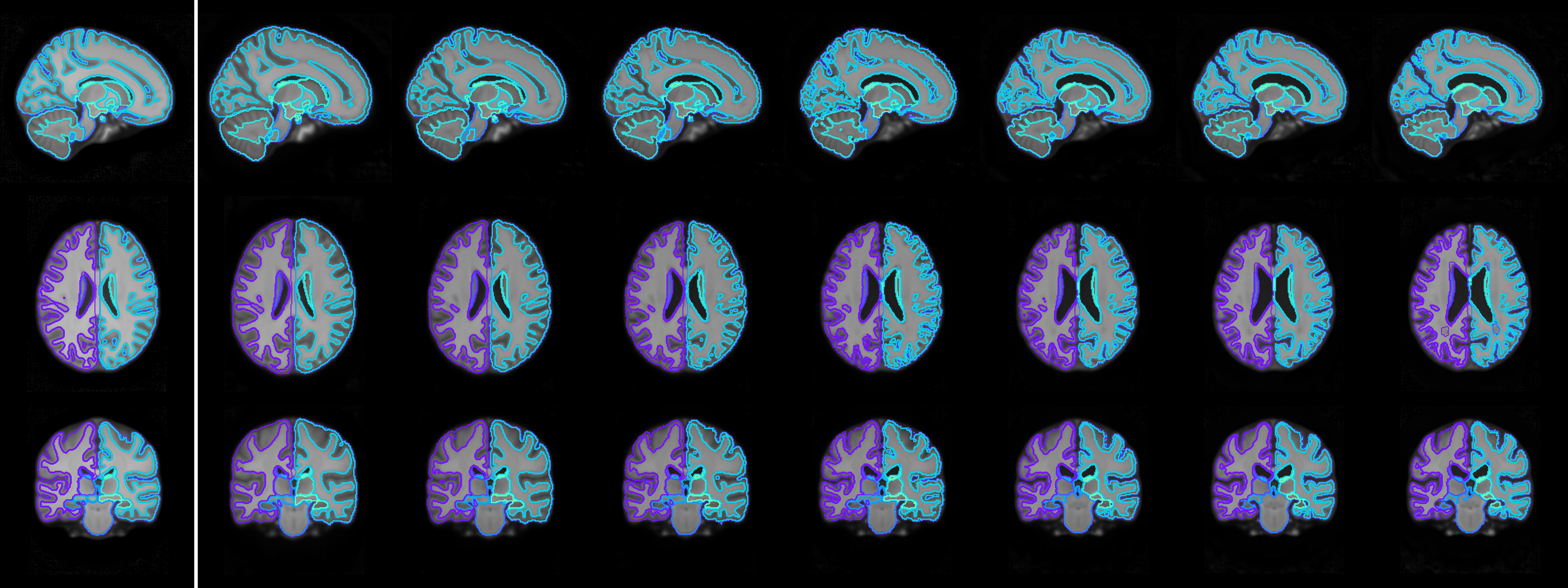 Learning Conditional Deformable Templates With Convolutional Networks Deepai 