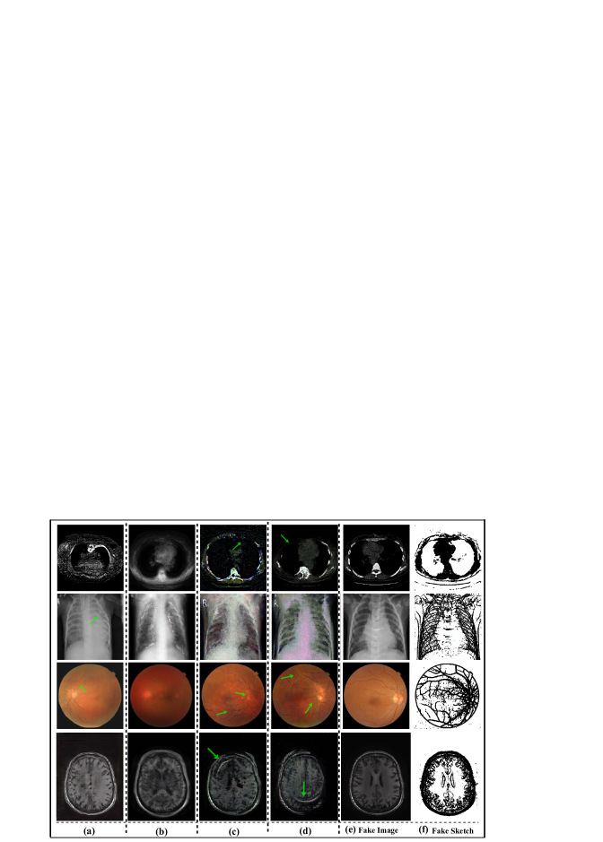 Skrgan Sketching Rendering Unconditional Generative Adversarial Networks For Medical Image