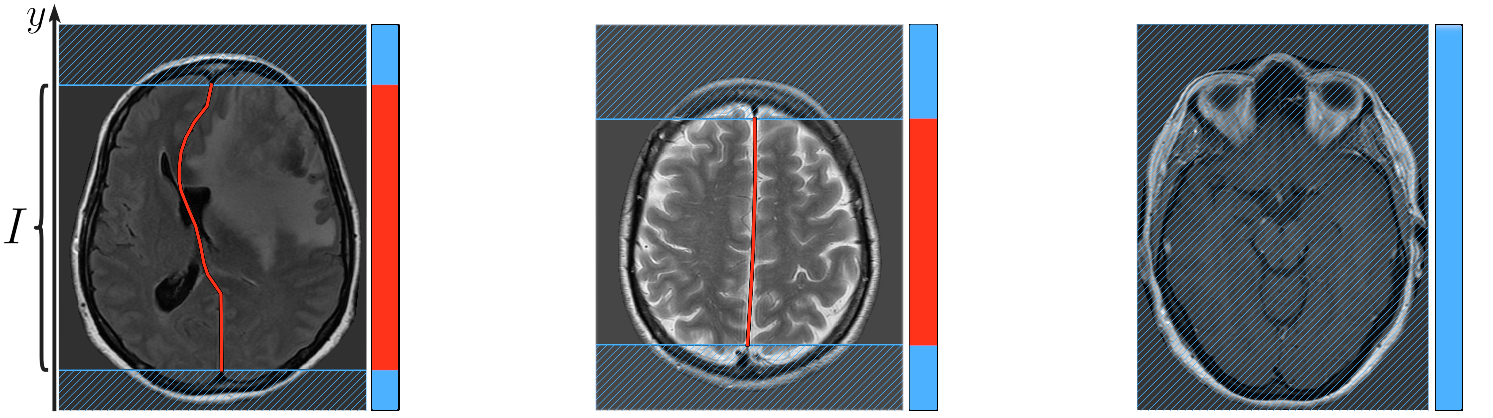 Incorporating Task-Specific Structural Knowledge into CNNs for Brain Midline Shift Detection ...