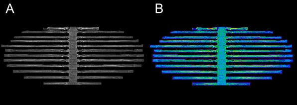 Automated Rib Fracture Detection Of Postmortem Computed Tomography Images Using Machine Learning