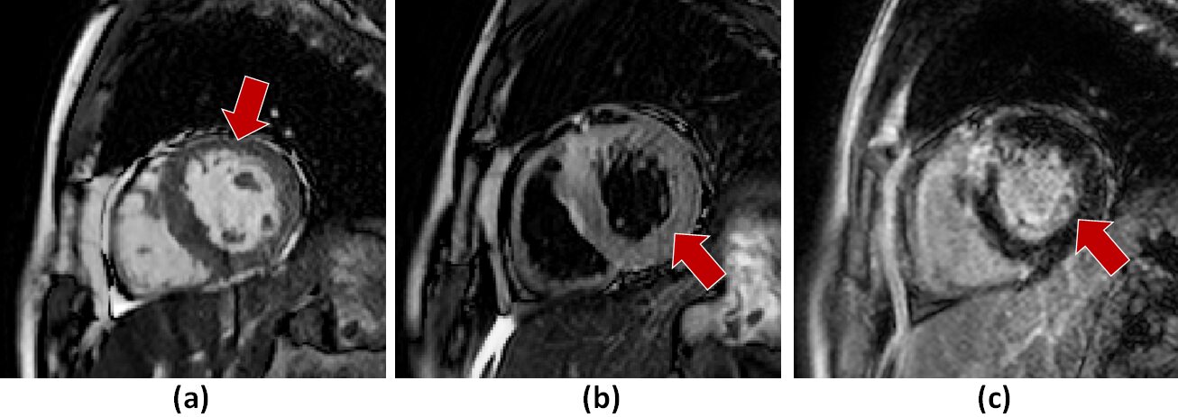 Automated Multi-sequence Cardiac MRI Segmentation Using Supervised Domain Adaptation | DeepAI