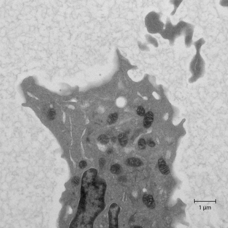 Synthetic patches, real images: screening for centrosome aberrations in ...