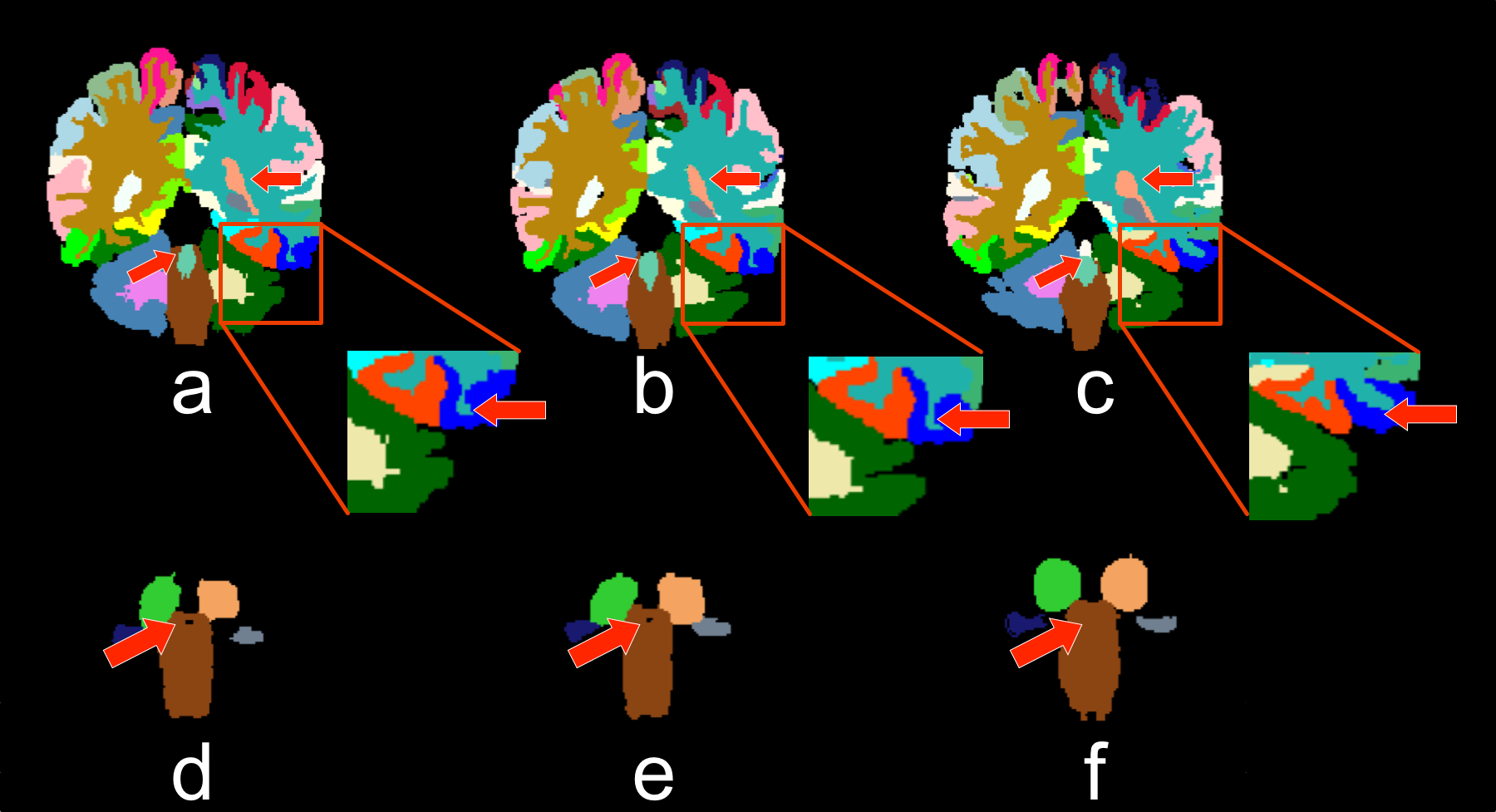 Transfer Learning From Partial Annotations For Whole Brain Segmentation