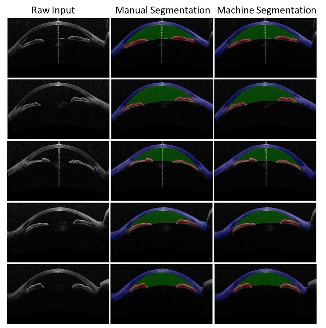 Deep Learning Algorithms to Isolate and Quantify the Structures of the Anterior Segment in ...