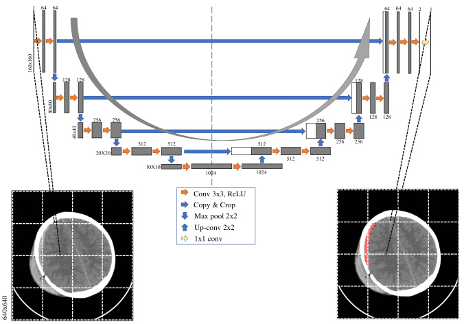 Intracranial Hemorrhage Segmentation Using Deep Convolutional Model | DeepAI