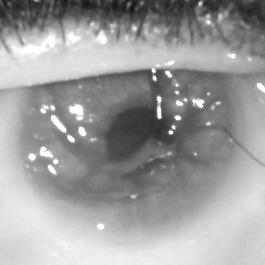 Post-mortem Iris Decomposition and its Dynamics in Morgue Conditions | DeepAI