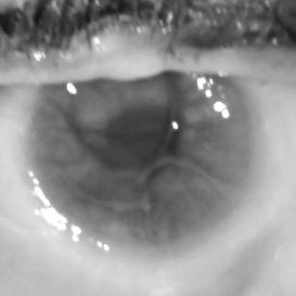 Post-mortem Iris Decomposition and its Dynamics in Morgue Conditions | DeepAI