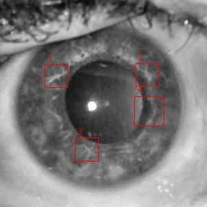 Post-mortem Iris Decomposition and its Dynamics in Morgue Conditions | DeepAI