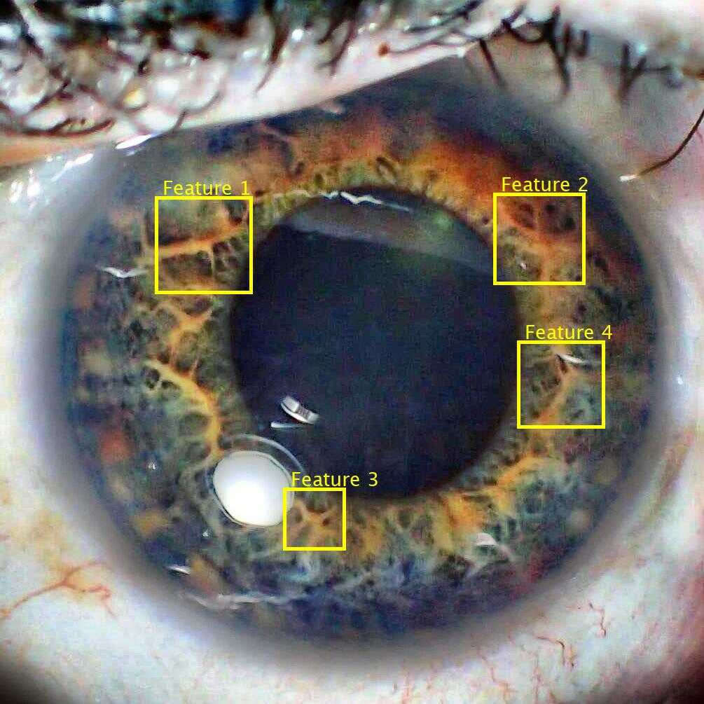 Post-mortem Iris Decomposition and its Dynamics in Morgue Conditions | DeepAI