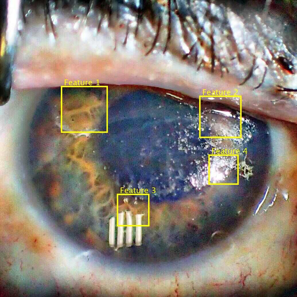 Post-mortem Iris Decomposition and its Dynamics in Morgue Conditions | DeepAI