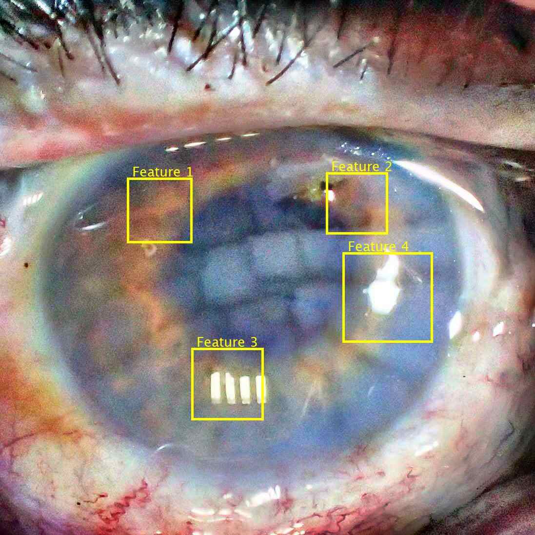 Post-mortem Iris Decomposition and its Dynamics in Morgue Conditions | DeepAI