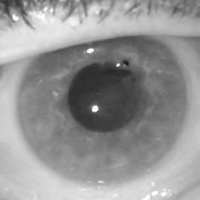 Post-mortem Iris Decomposition and its Dynamics in Morgue Conditions | DeepAI