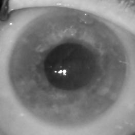 Post-mortem Iris Decomposition and its Dynamics in Morgue Conditions | DeepAI