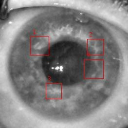 Post-mortem Iris Decomposition and its Dynamics in Morgue Conditions | DeepAI