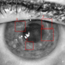Post-mortem Iris Decomposition and its Dynamics in Morgue Conditions | DeepAI