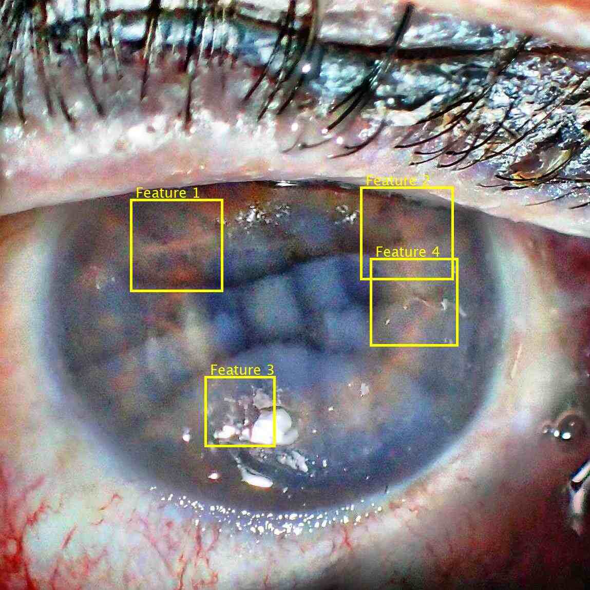 Post-mortem Iris Decomposition and its Dynamics in Morgue Conditions ...